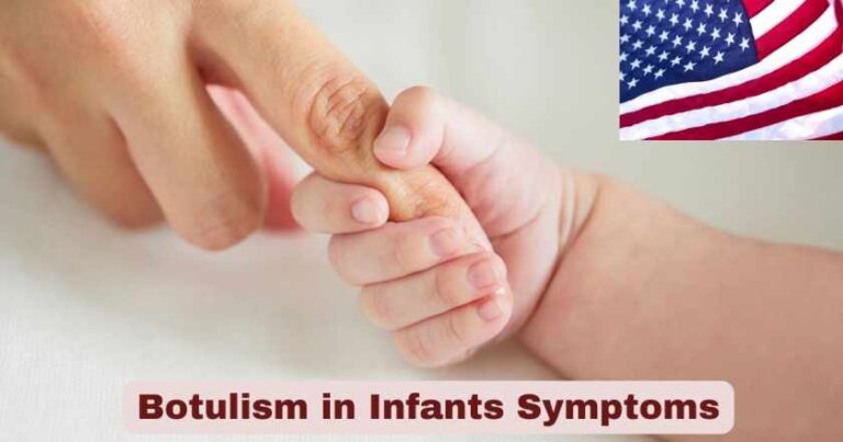 Botulism in Infants Symptoms in US 2025 | Statistics & Facts - The ...