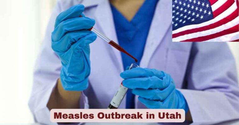 Measles Outbreak in Utah 2025 | Statistics & Facts - The World Data