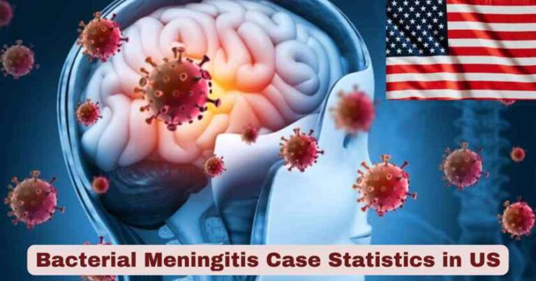 Bacterial Meningitis Case Statistics in US 2026 | Key Facts - The World ...