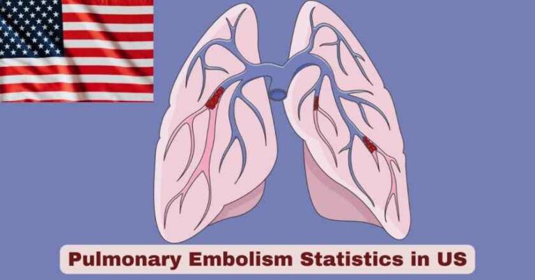 Pulmonary Embolism Statistics in US 2026 | Key Facts - The World Data