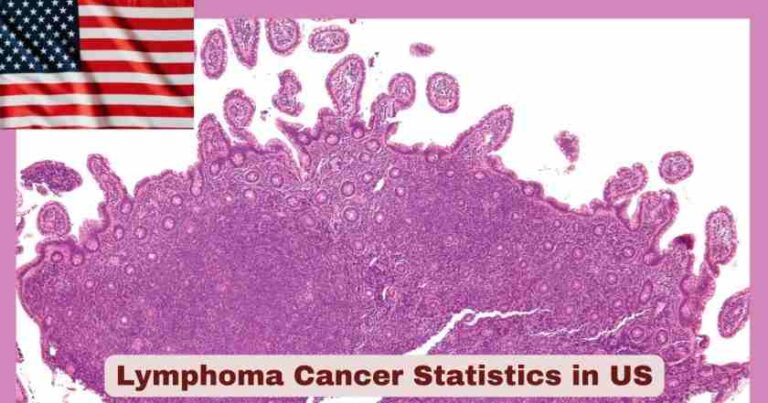 Lymphoma Cancer Statistics in US 2026 | Key Facts - The World Data